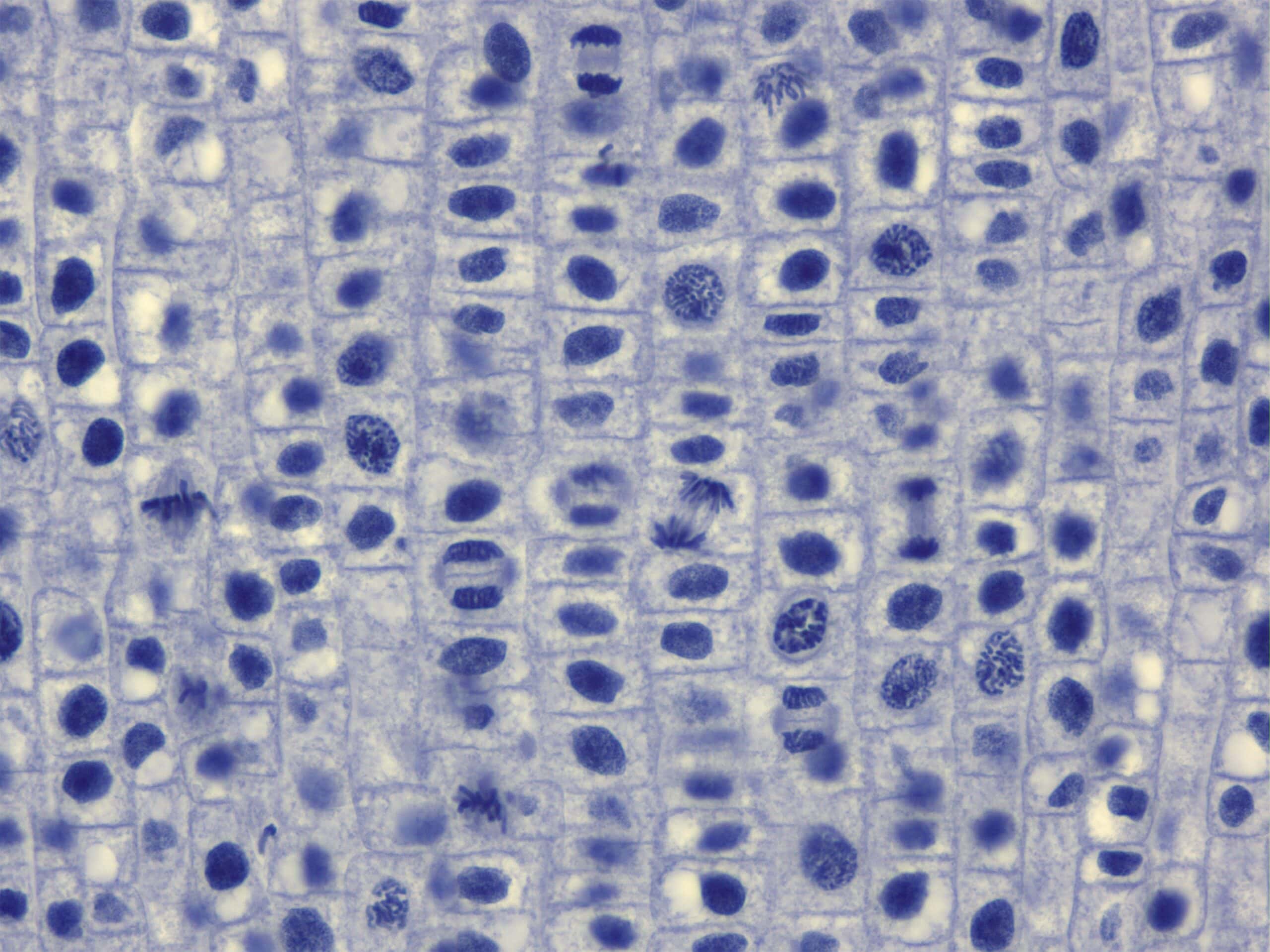 MR002 Mitosis Onion Root Tip Valley Microscope