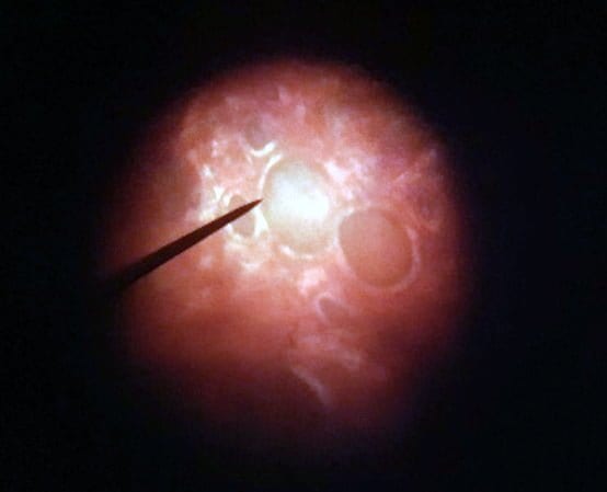 Reproductive Systems - Valley Microscope